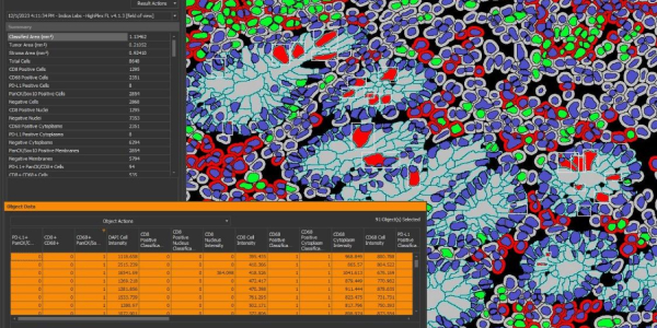 Instruments and Technology | Precision for Medicine
