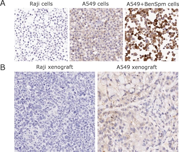 Developing an Immunohistochemistry Assay for Human Spermine Oxidase