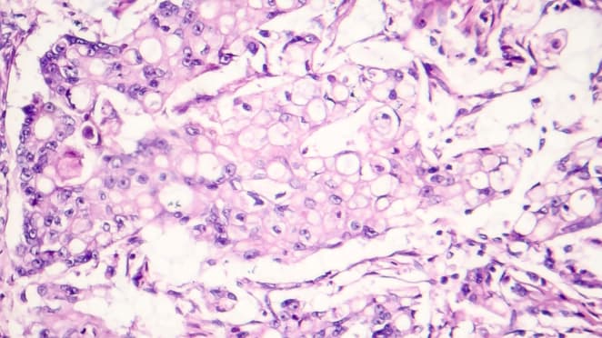 High Quality Human Biospecimens | Precision for Medicine