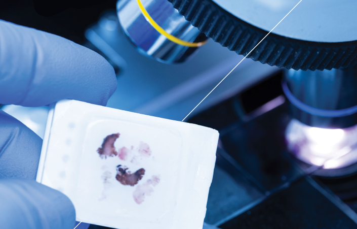 Custom Tissue Microarrays (TMAs) | Precision for Medicine