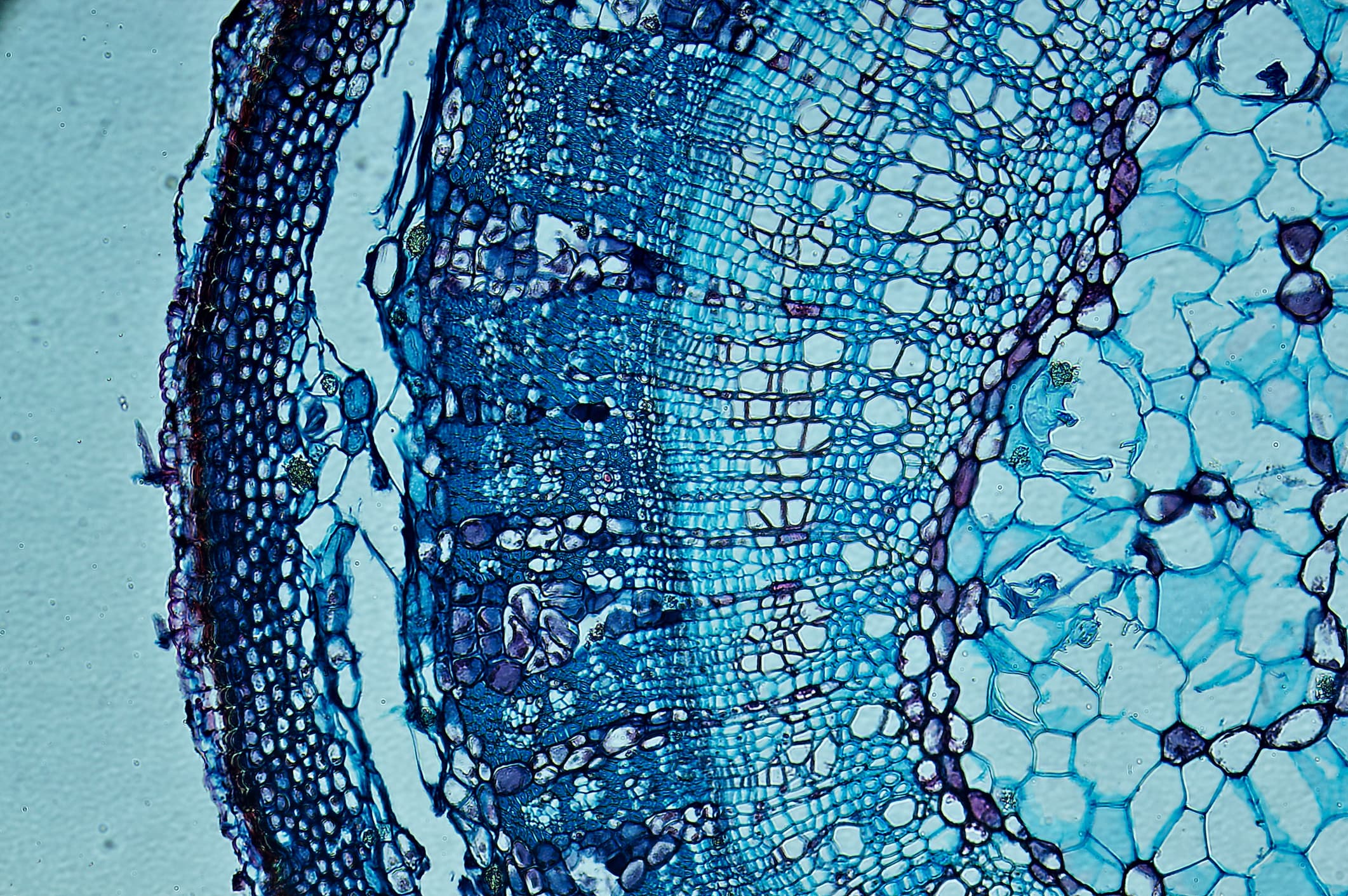 Fresh & Frozen Tissue Samples | Precision for Medicine