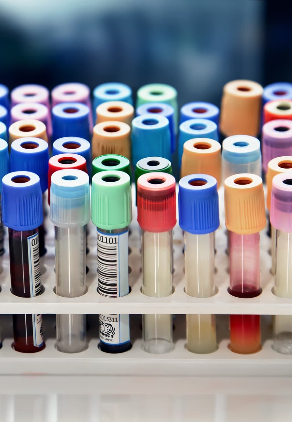 Custom Biospecimen Procurement | Precision for Medicine