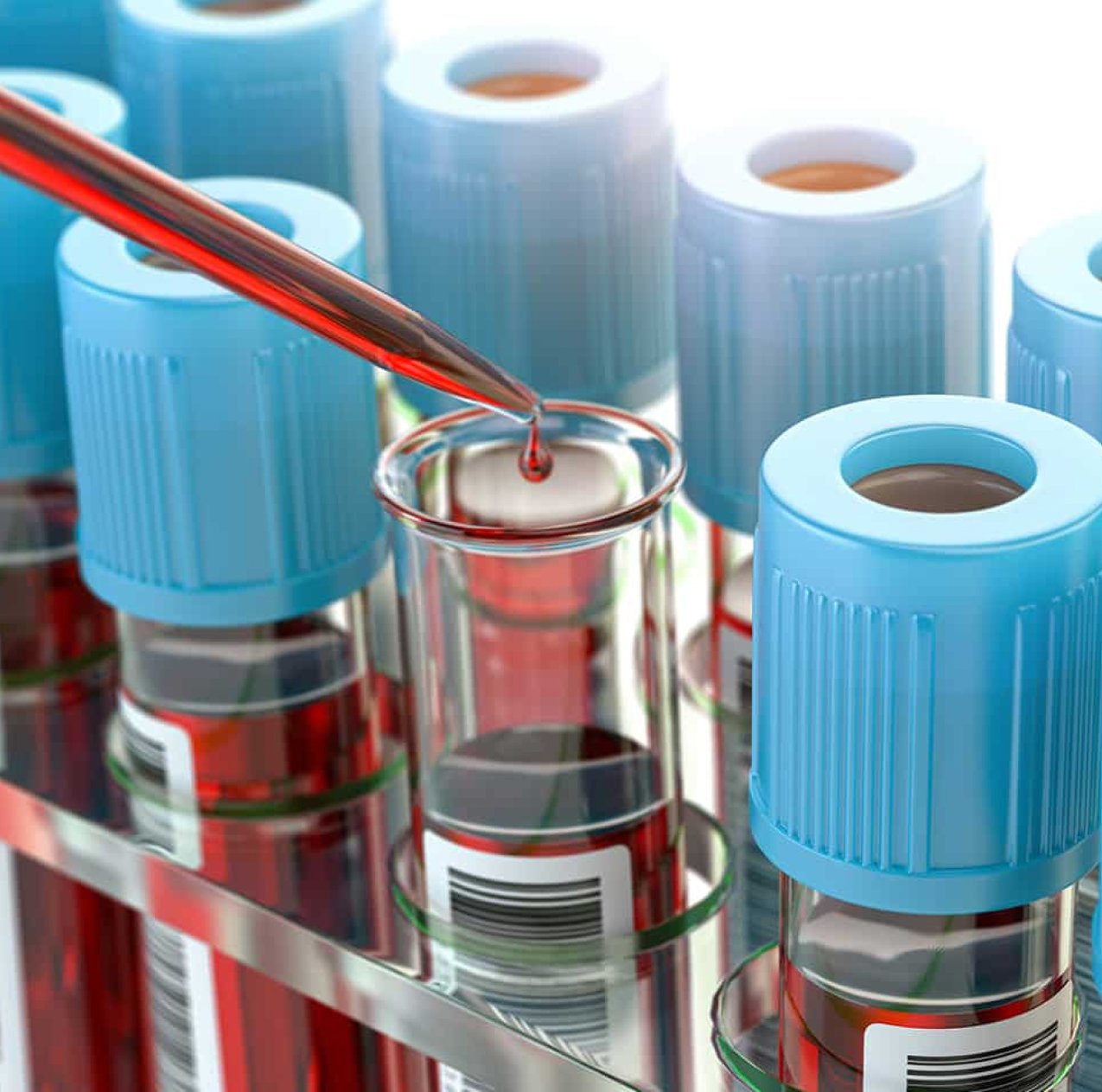 Clinical Specimen Kitting | Precision For Medicine