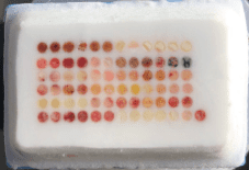 Human Tissue Samples | Precision for Medicine