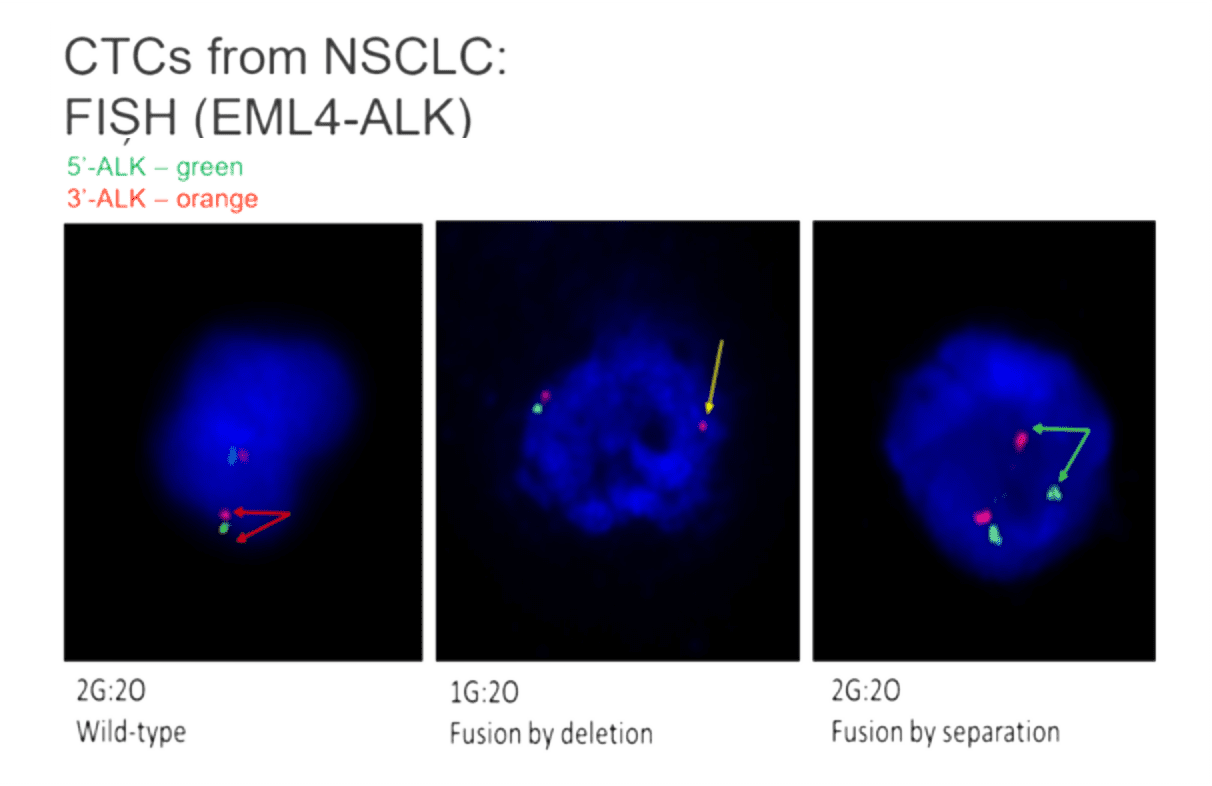 Fluorescence In Situ Hybridization Services | Precision for Medicine