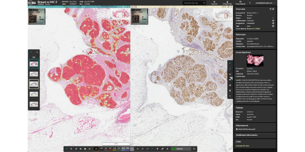 Instruments and Technology | Precision for Medicine