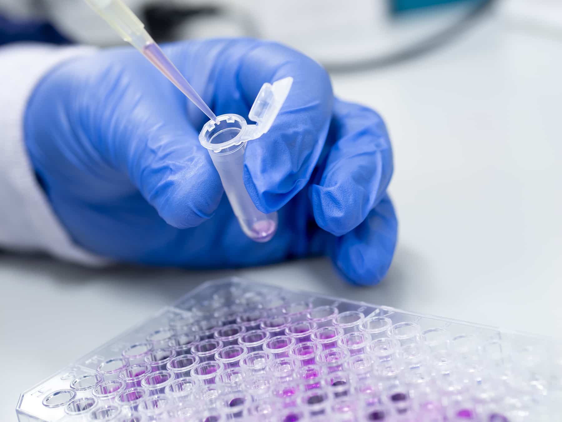 Droplet Digital PCR Services | Precision for Medicine