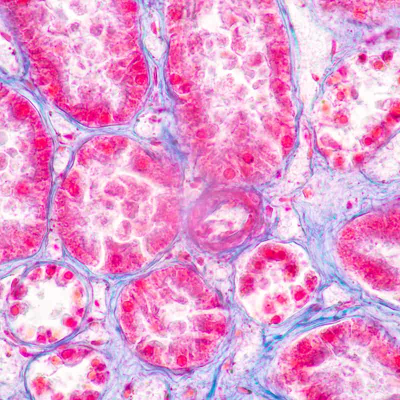 Pharmacokinetic (PK) Assays | Precision for Medicine