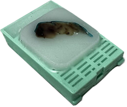 Fresh & Frozen Tissue Samples | Precision for Medicine