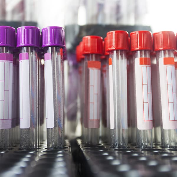 Central Lab Services | Precision For Medicine