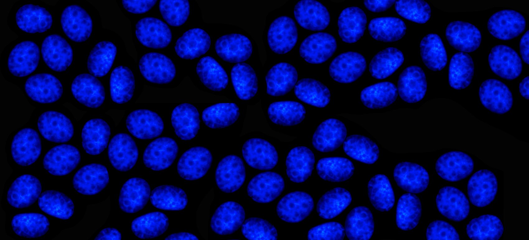 FluoroSpot & ELISpot Testing | Precision for Medicine