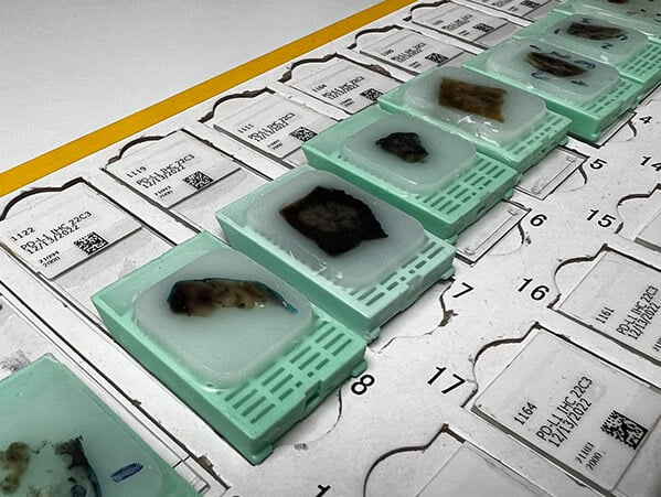 NGS-Characterized Biospecimens | Precision for Medicine