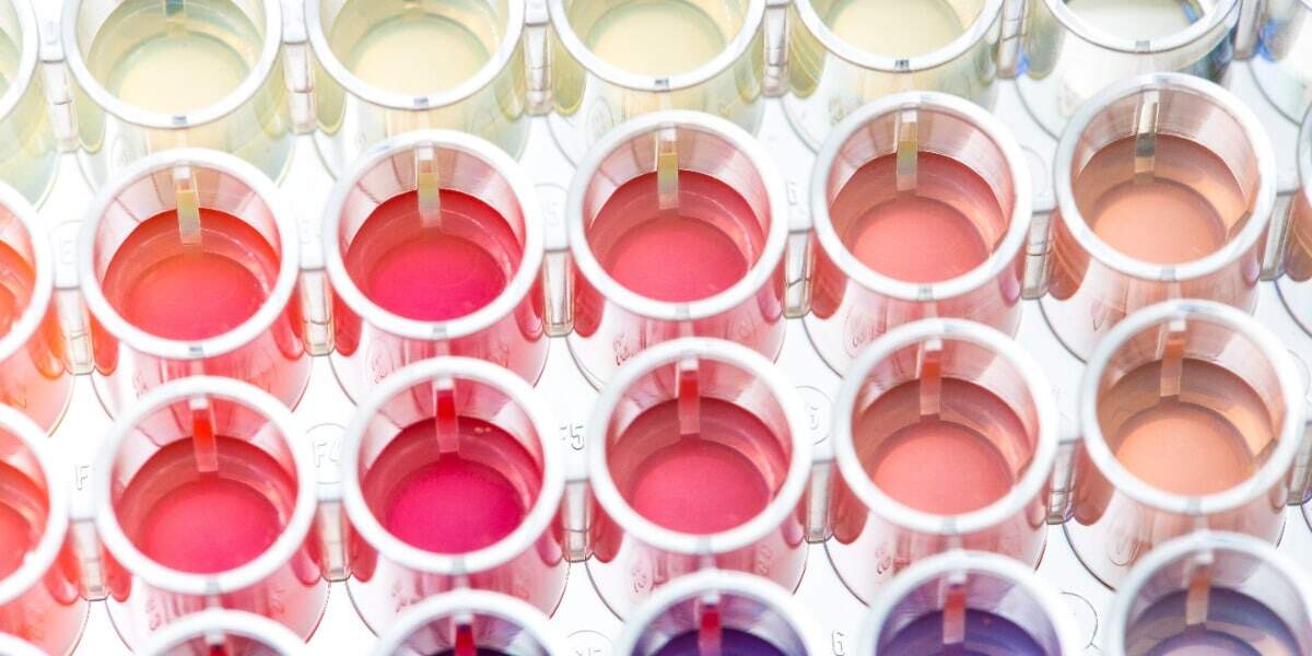 Protein Assays: Choosing the Most Effective Method for ...